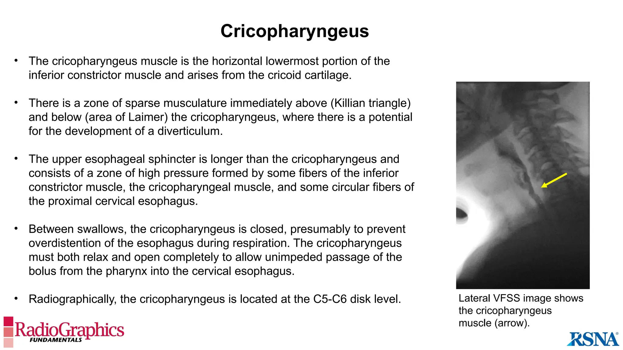 videoflouroscopy radiographics RSNA..... | PPTX
