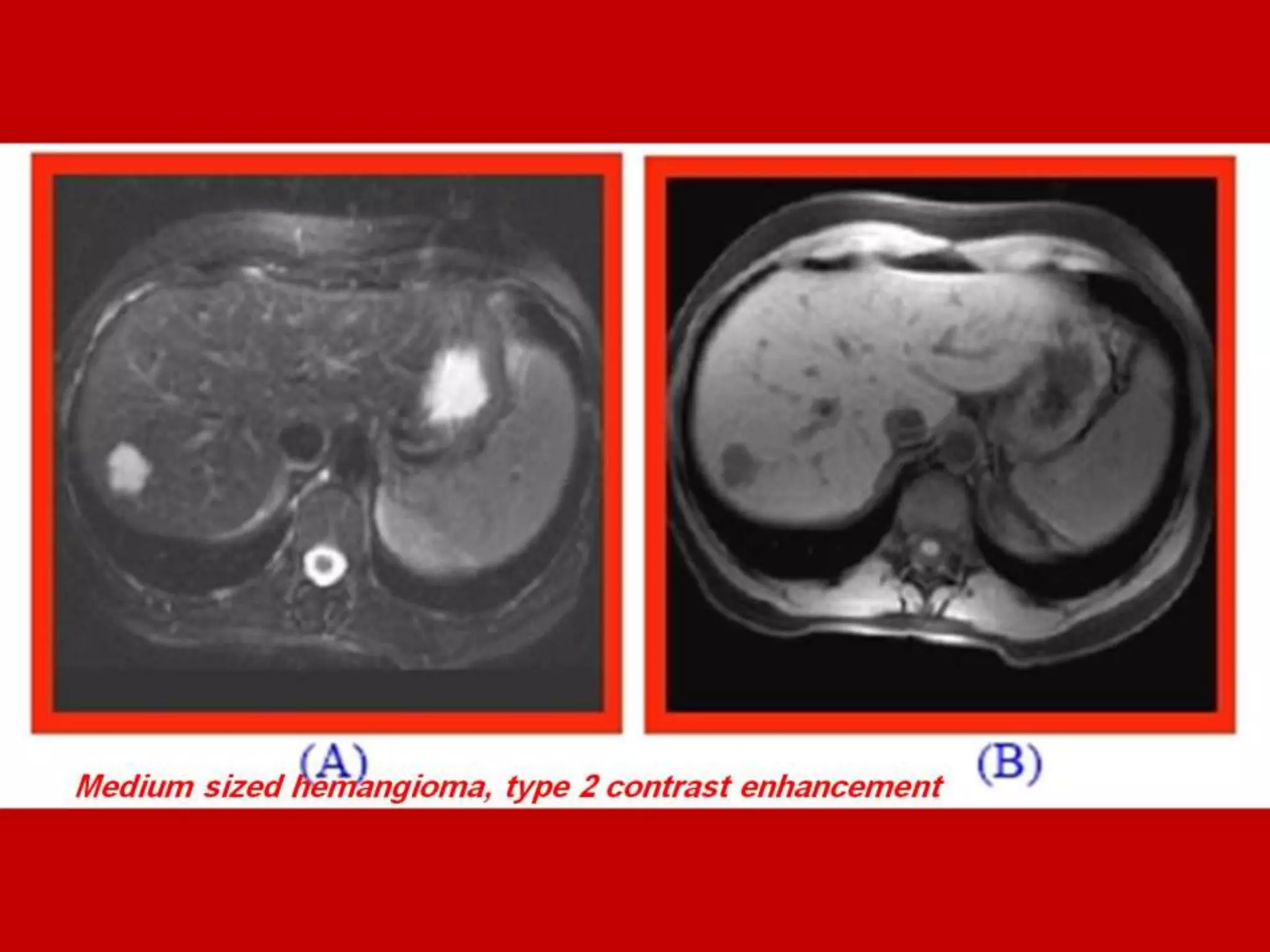 39-Dr Ahmed Esawy imaging oral board of liver part III MRI liver | PPT