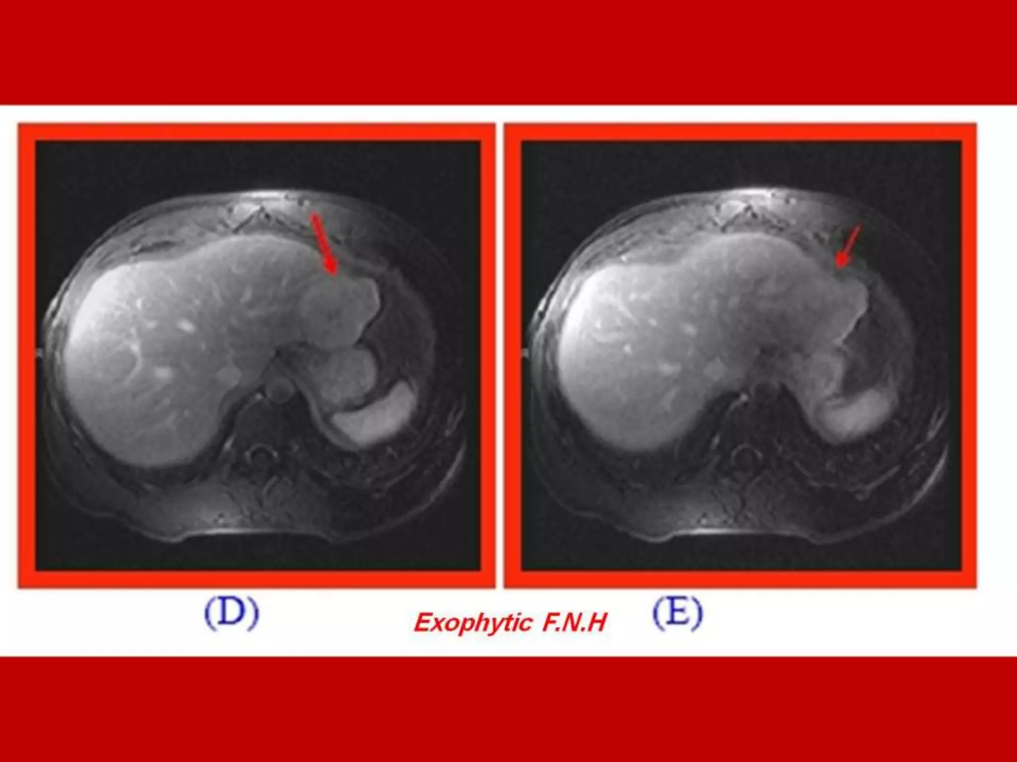 39-Dr Ahmed Esawy imaging oral board of liver part III MRI liver | PPT