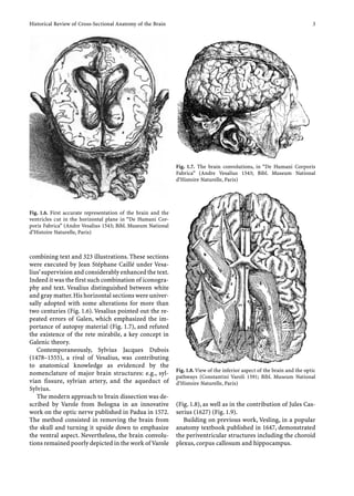 Atlas of Regional ANATOMY of the Brain Using MRI | PDF