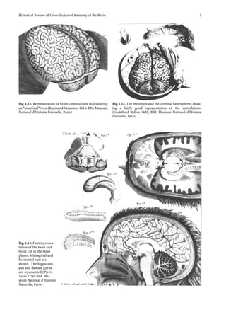 Atlas of Regional ANATOMY of the Brain Using MRI | PDF