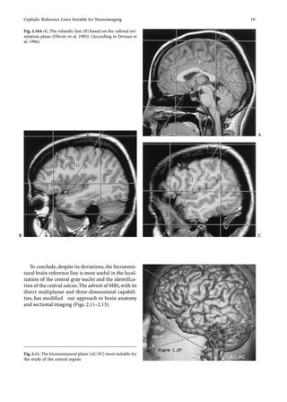 Atlas of Regional ANATOMY of the Brain Using MRI | PDF