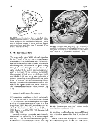 Atlas of Regional ANATOMY of the Brain Using MRI | PDF