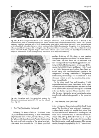 Atlas of Regional ANATOMY of the Brain Using MRI | PDF