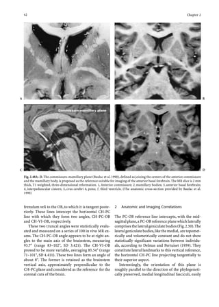 Atlas of Regional ANATOMY of the Brain Using MRI | PDF