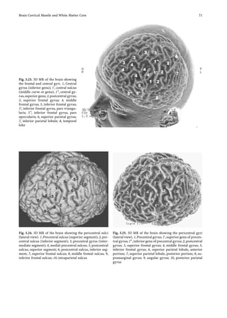 Atlas of Regional ANATOMY of the Brain Using MRI | PDF