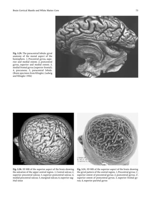 Atlas of Regional ANATOMY of the Brain Using MRI | PDF