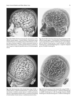 Atlas of Regional ANATOMY of the Brain Using MRI | PDF