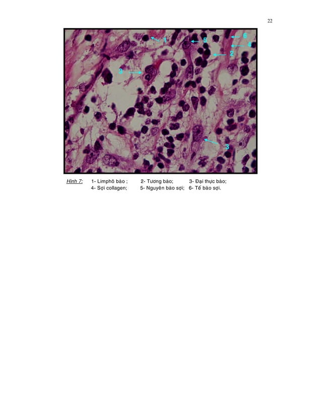 Bài Giảng, Atlas Thực Tập Giải Phẫu Bệnh ĐH Y Phạm Ngọc Thạch | PDF