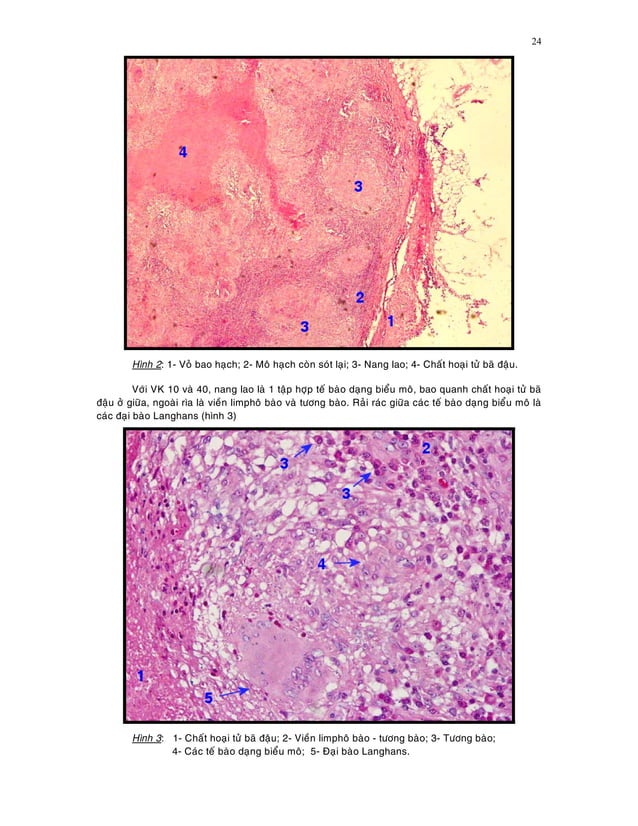 Bài Giảng, Atlas Thực Tập Giải Phẫu Bệnh ĐH Y Phạm Ngọc Thạch | PDF