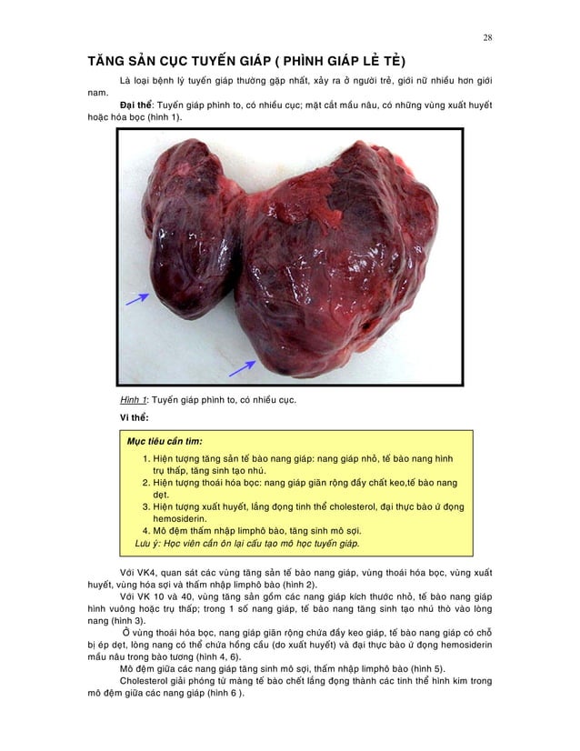 Bài Giảng, Atlas Thực Tập Giải Phẫu Bệnh ĐH Y Phạm Ngọc Thạch | PDF