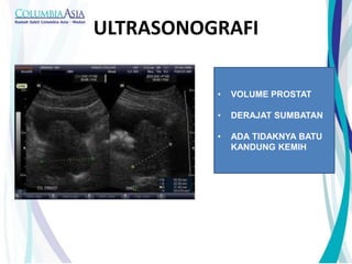 391573995-Presentasi-Prostat-Awam.pptx