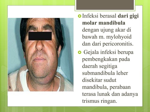 392060383-abses-mandibula definisi-ppt.pptx