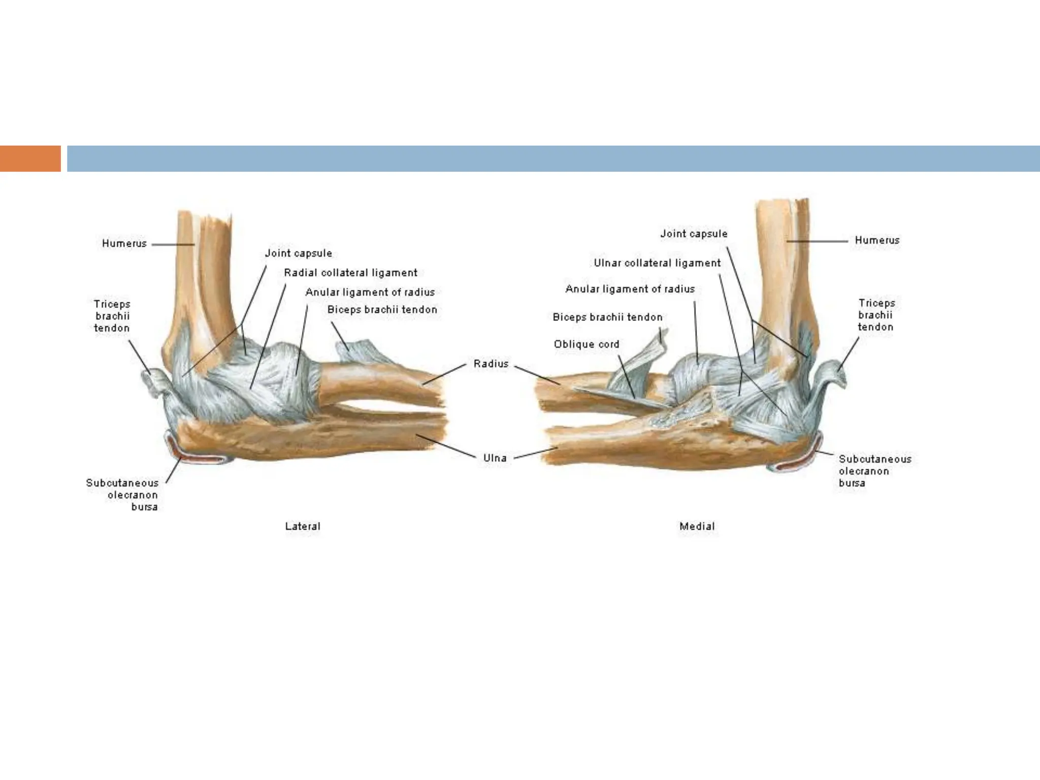 Hemartrosis (Pendarahan sendi) in Englis | PPT