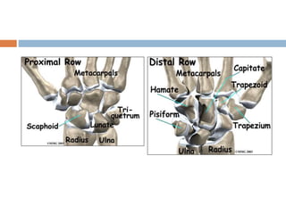Hemartrosis (Pendarahan sendi) in Englis | PPT