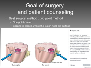 394 Supratentorial and infratentorial cavernous malformation | PPT ...