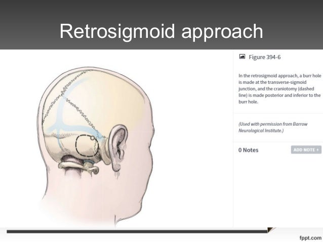 394 Supratentorial and infratentorial cavernous malformation