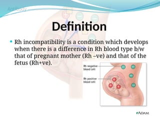 396411973-Rh-Incompatability-Final-PPT.pptx