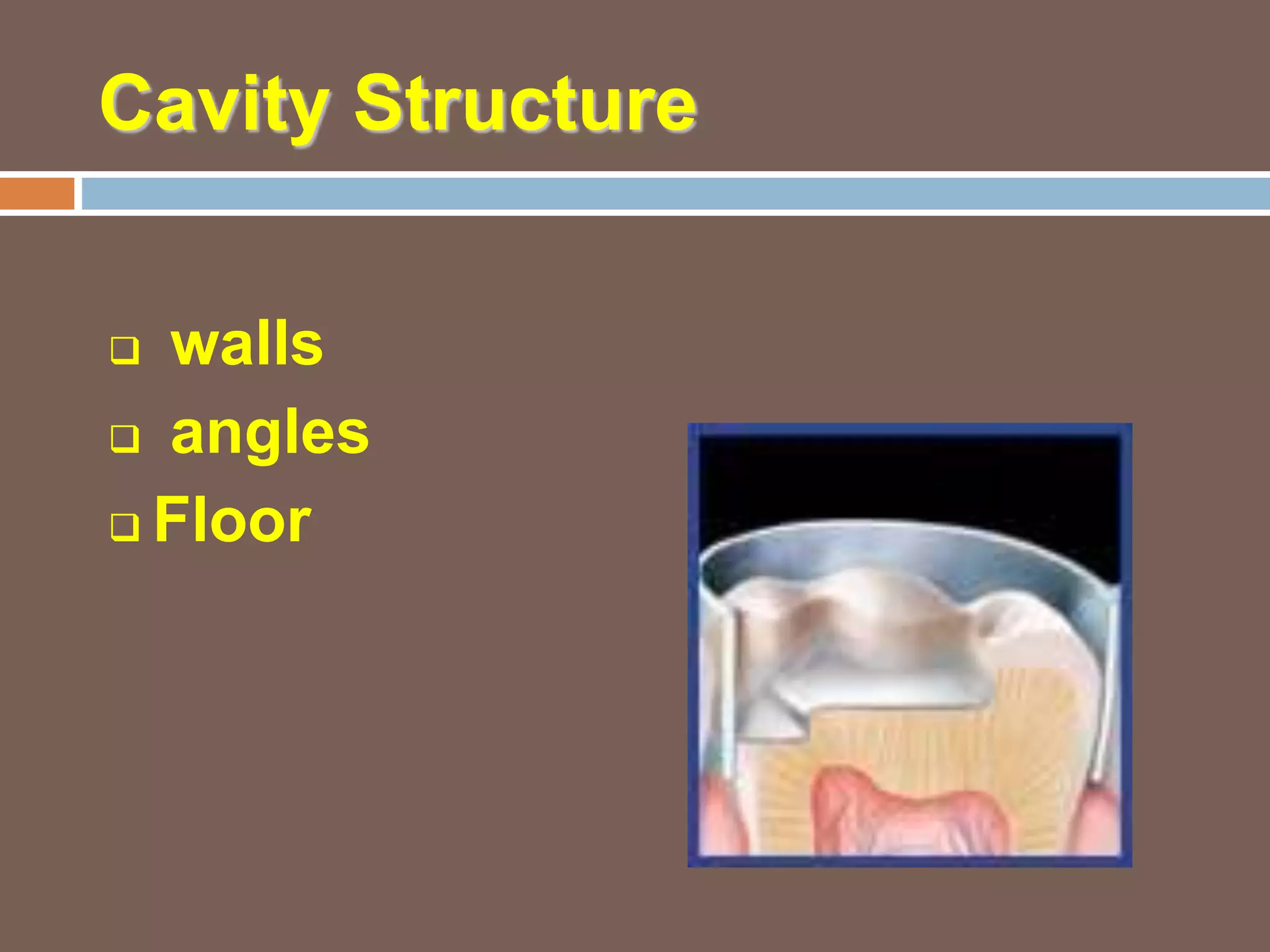 fundamentals of tooth preparation.ppt
