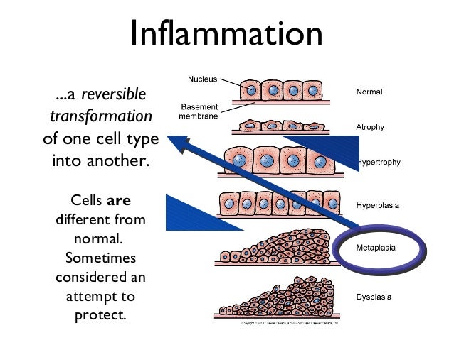 Role of Inflammation, Genetics, Epigenetics, and Stem Cells in Tumori…