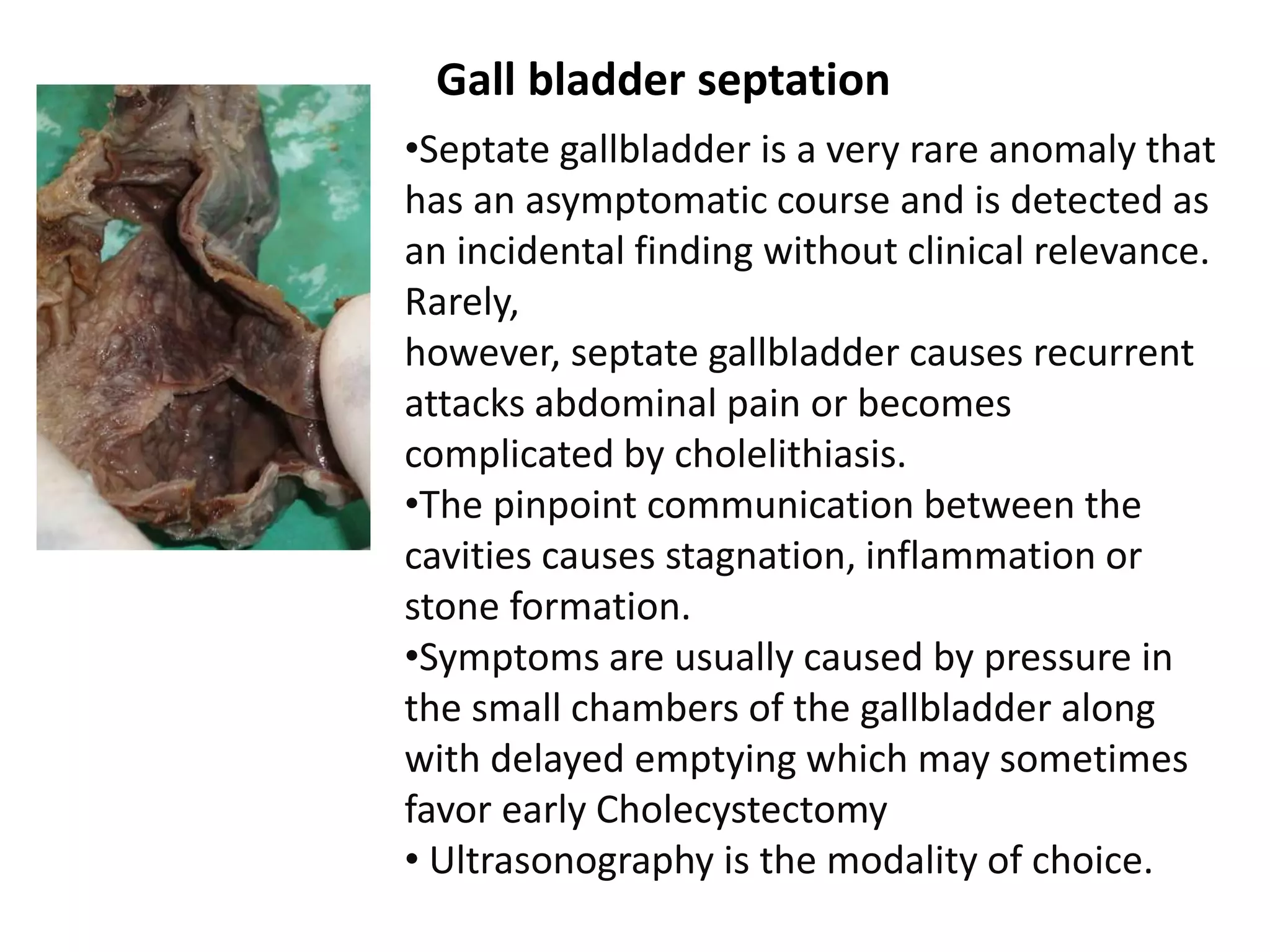 Gallbladder Disease in Children | PPTX
