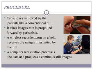 Pill_Camera .pptx