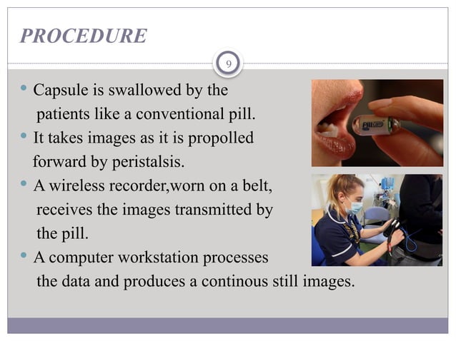 Pill_Camera .pptx | Free Download