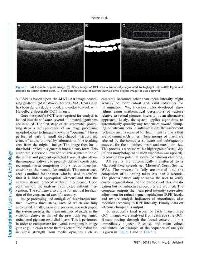 Puplication-Assesssment of Vitritis On OCT-Journel TVST | PDF | Eye and Vision Conditions ...