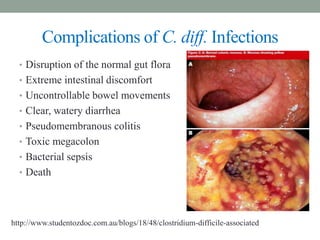Schaefer, Joseph, R. Fidaxomicin Presentation | PPTX