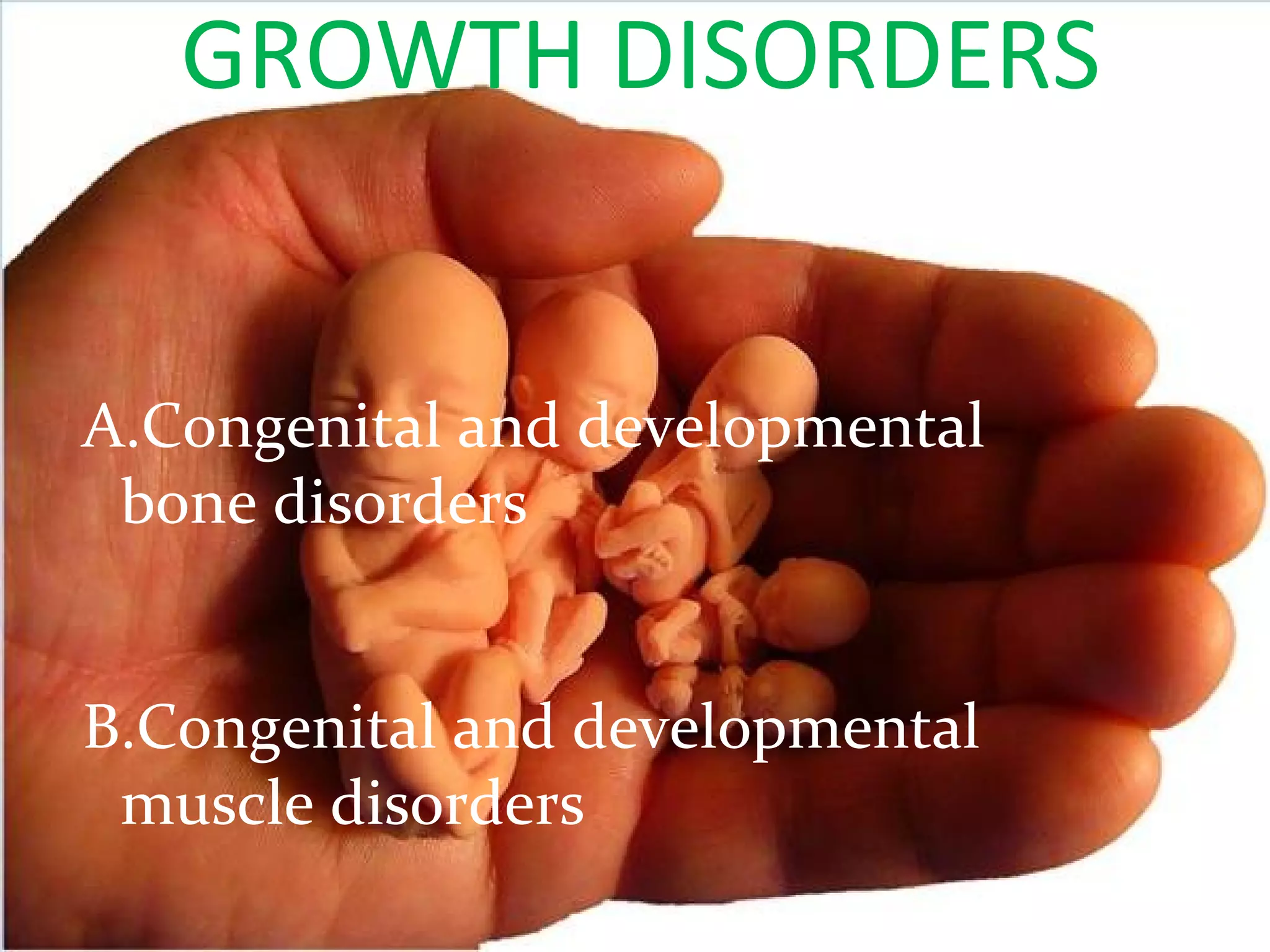condyle disc-complex_derangement_1 | PPT