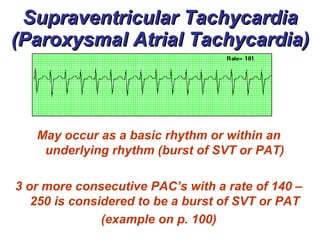 Atrial Rhythms - BMH/Tele | PPT