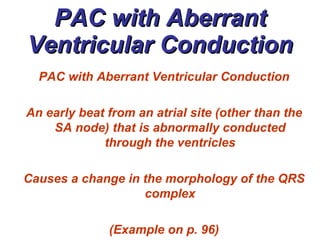 Atrial Rhythms - BMH/Tele | PPT