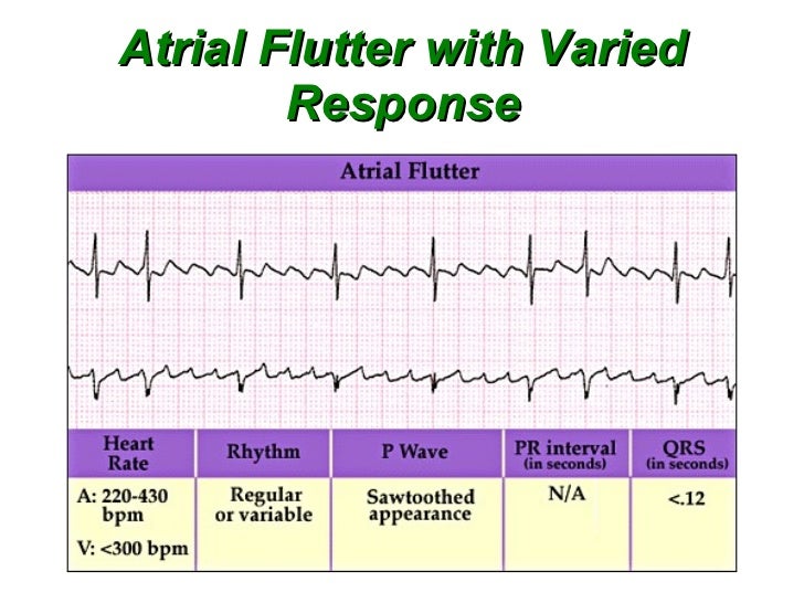 Atrial Rhythms - BMH/Tele