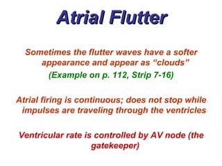 3a atrial rhythms | PPT