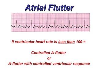 3a atrial rhythms | PPT