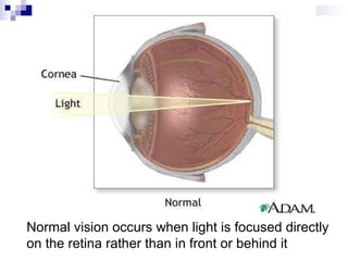 Chapter 14 The Human Eye Lesson 3 - The 2 Mechanisms of the Eye 1 ...