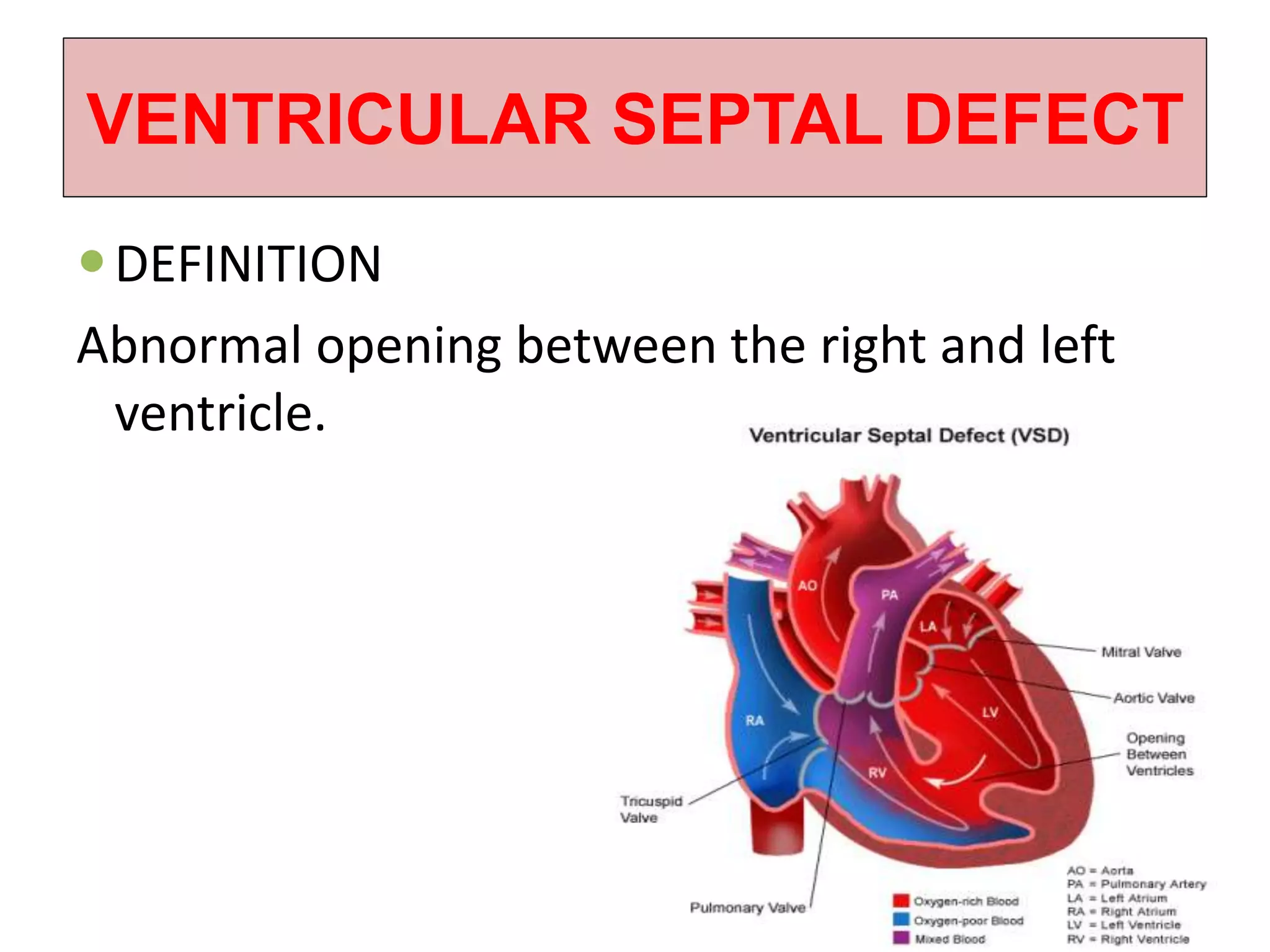 CONGENITAL HEART DISEASES | PPT