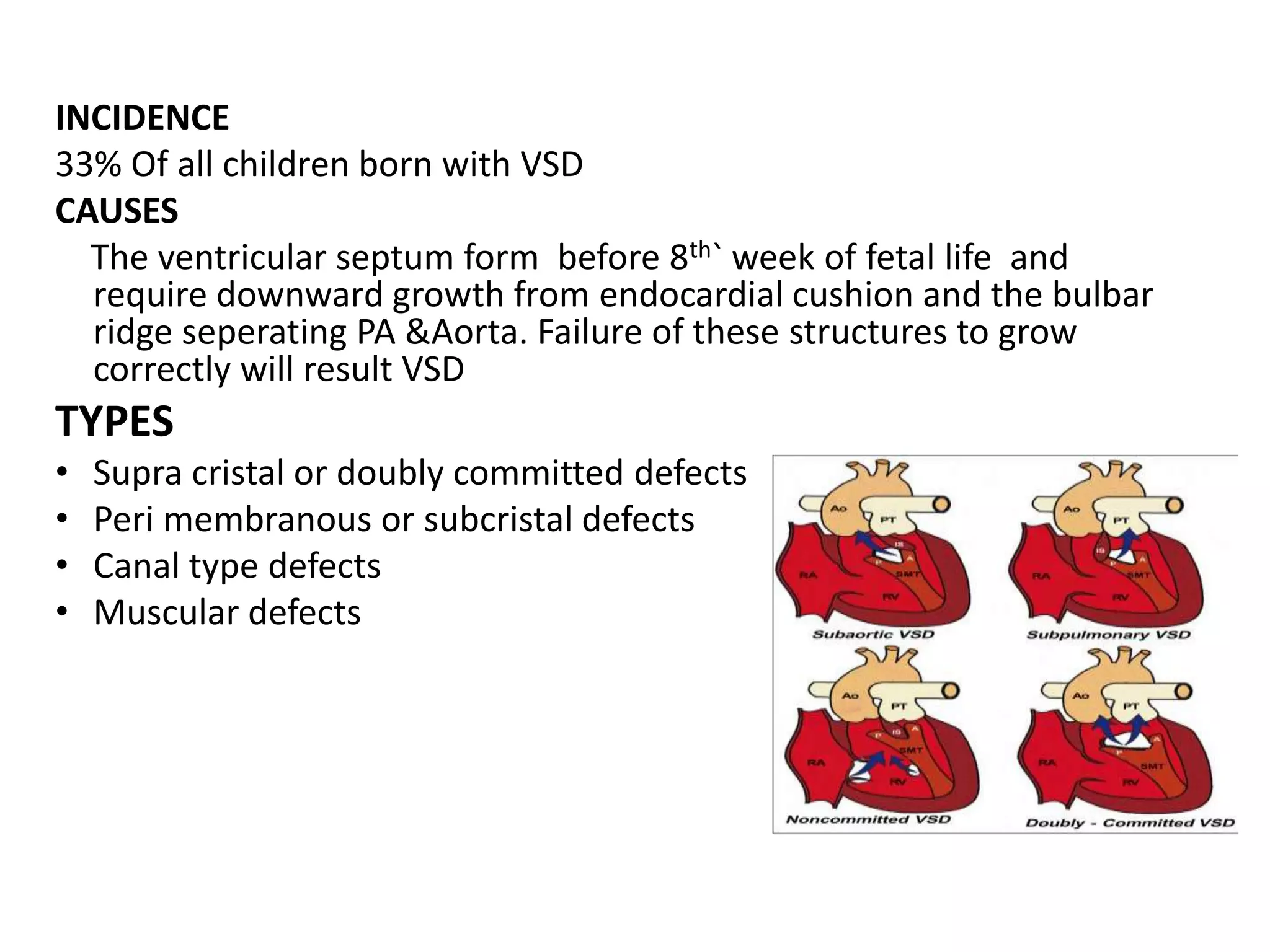 CONGENITAL HEART DISEASES | PPT