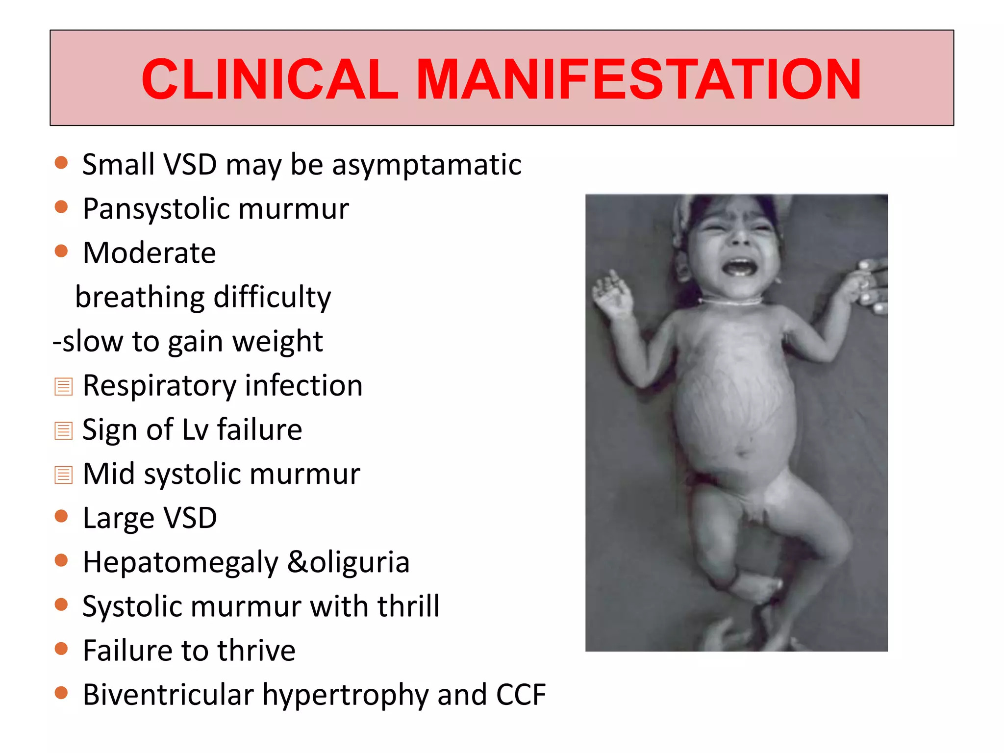 CONGENITAL HEART DISEASES | PPT