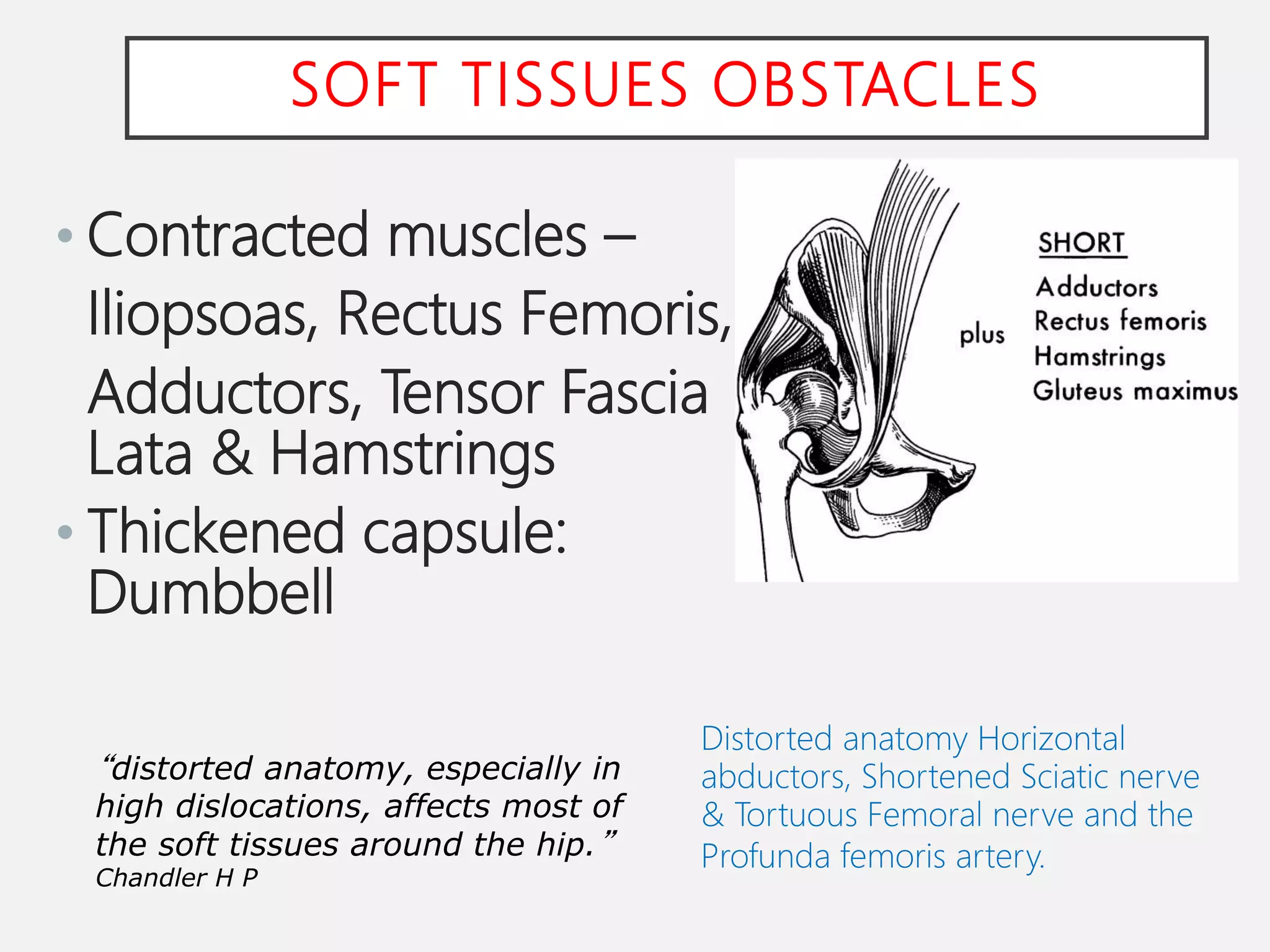 3a ddh open reduction principles & protocols | PPT