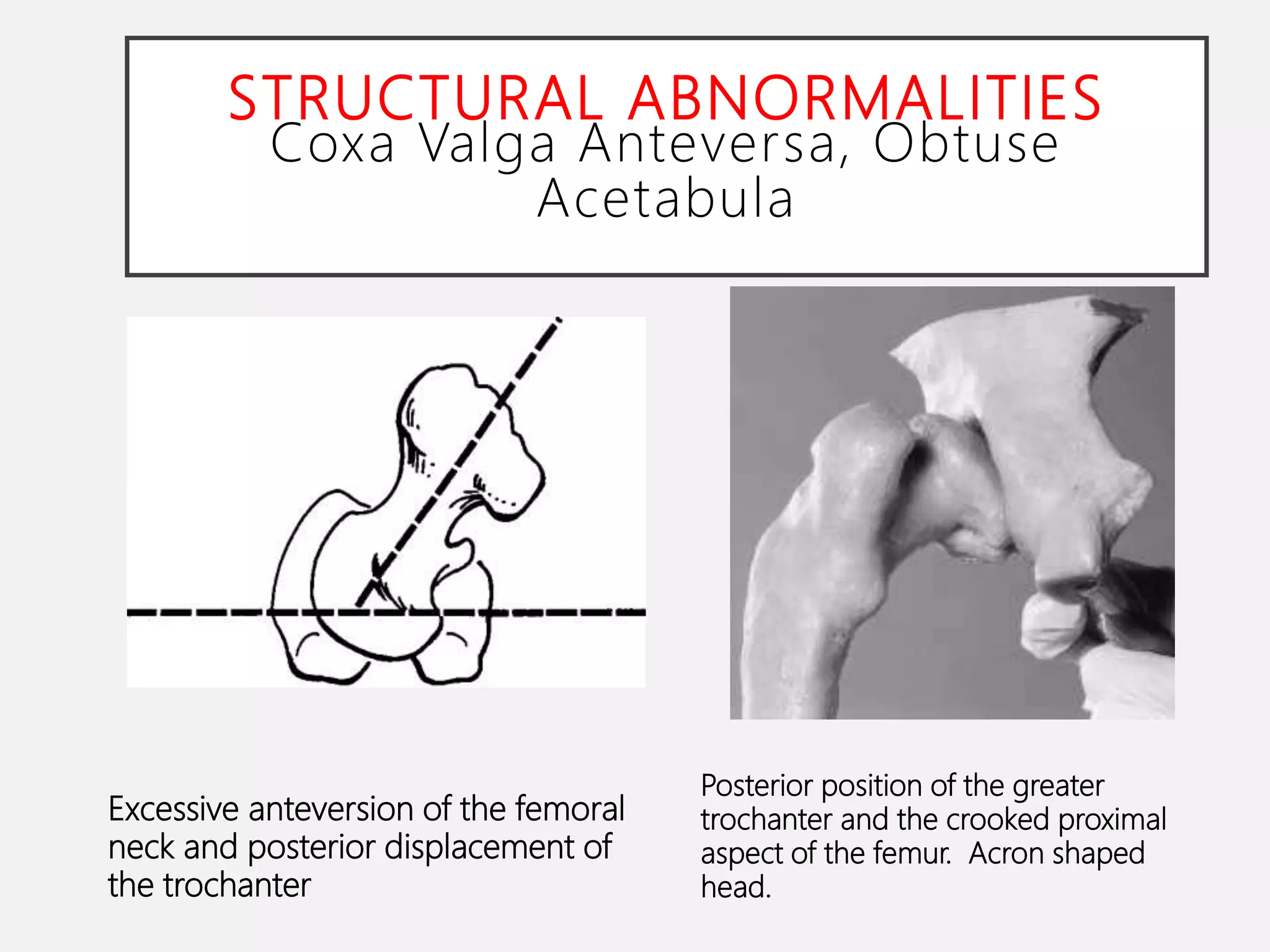 3a ddh open reduction principles & protocols | PPT