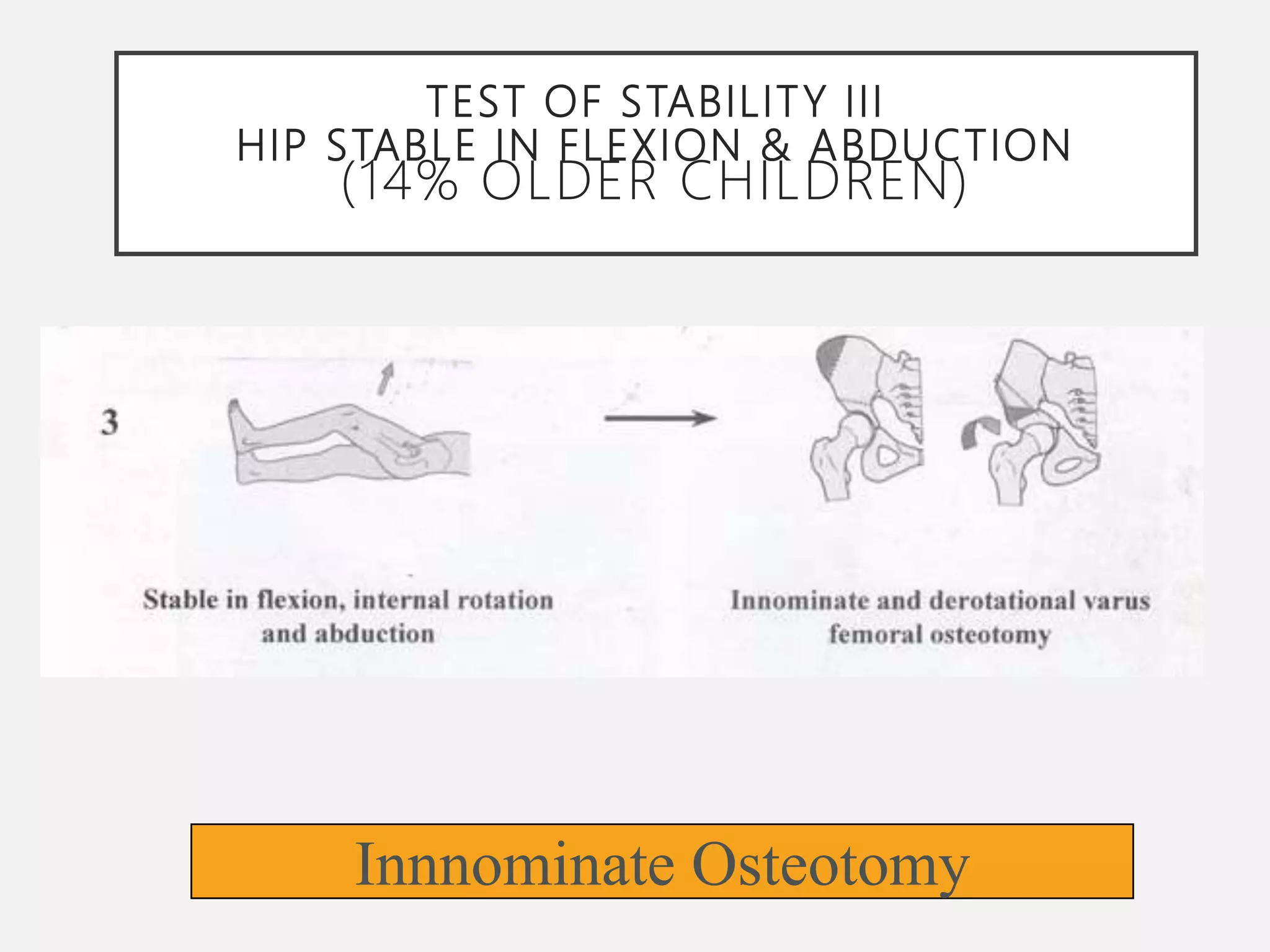 3a ddh open reduction principles & protocols | PPT