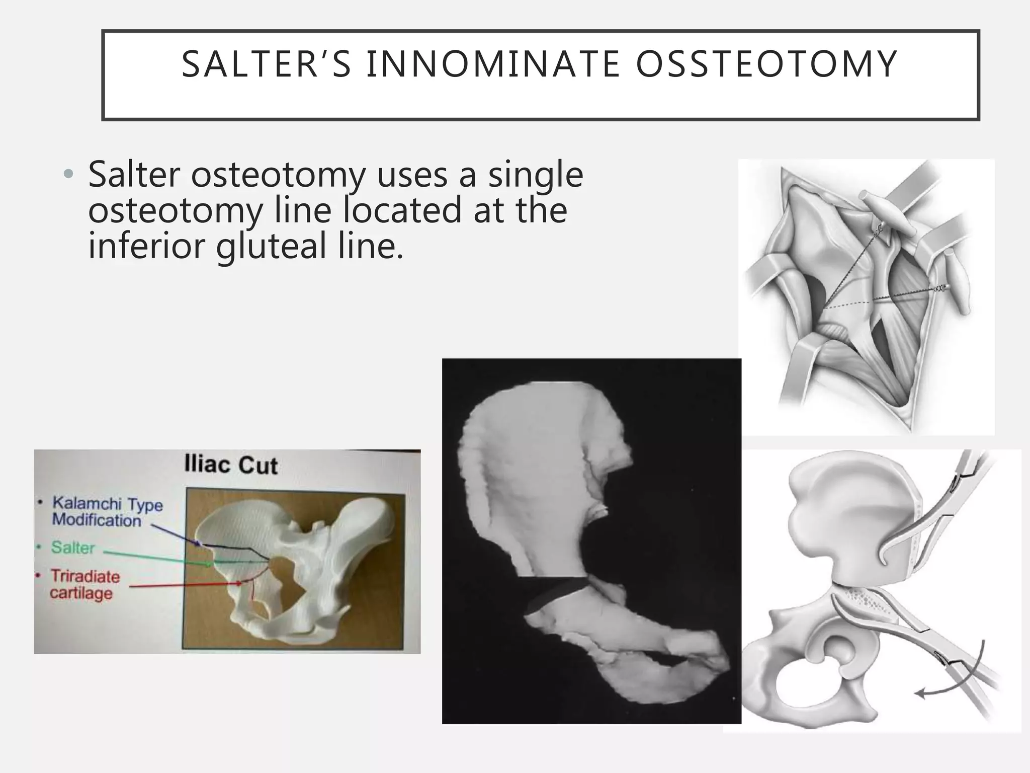 3a ddh open reduction principles & protocols | PPT