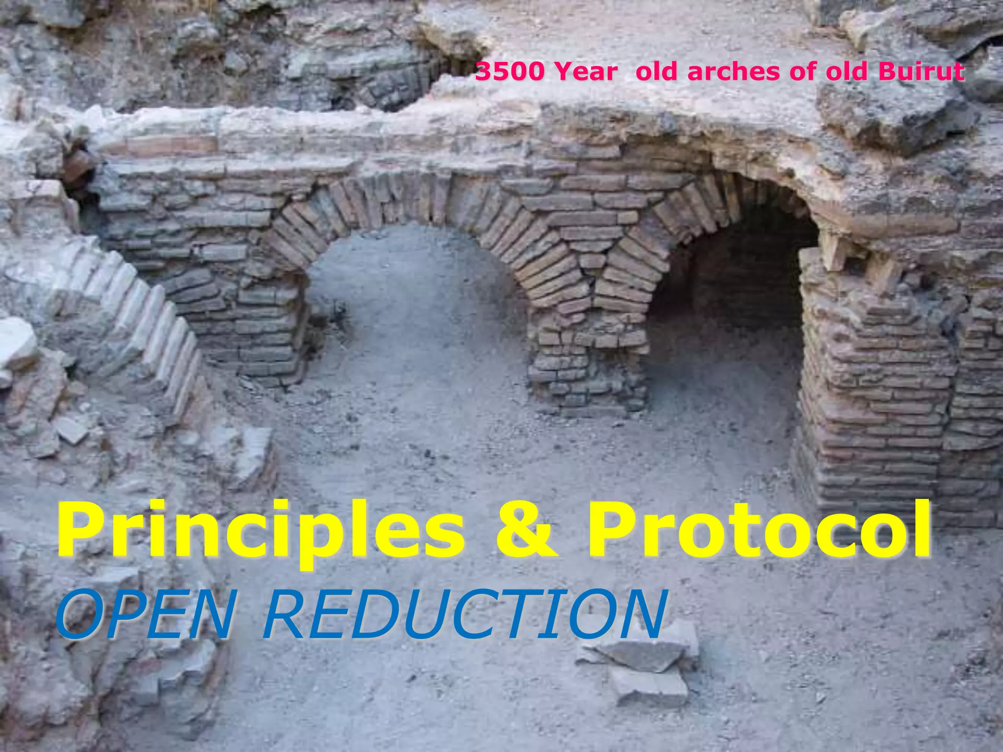 3a ddh open reduction principles & protocols | PPT