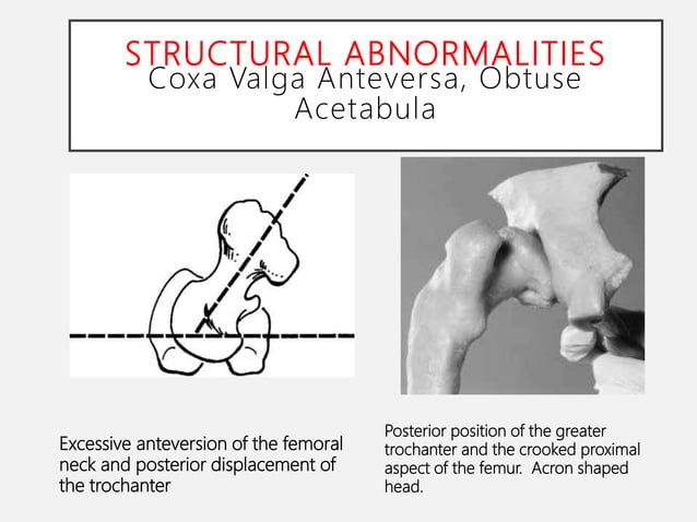 3a ddh open reduction principles & protocols | PPT