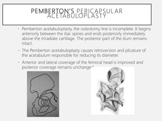 3a ddh open reduction principles & protocols | PPT