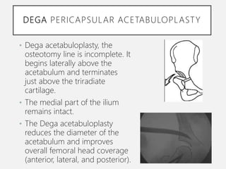 3a ddh open reduction principles & protocols | PPT