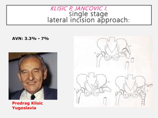 3a ddh open reduction principles & protocols | PPT