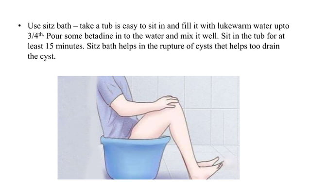 CASE PRESENTATION ON BILATERAL BARTHOLIN CYST