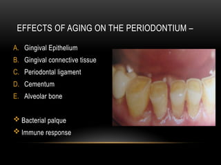 3 AGING AND PERIODONTIUM.pptx in periodontology | PPT